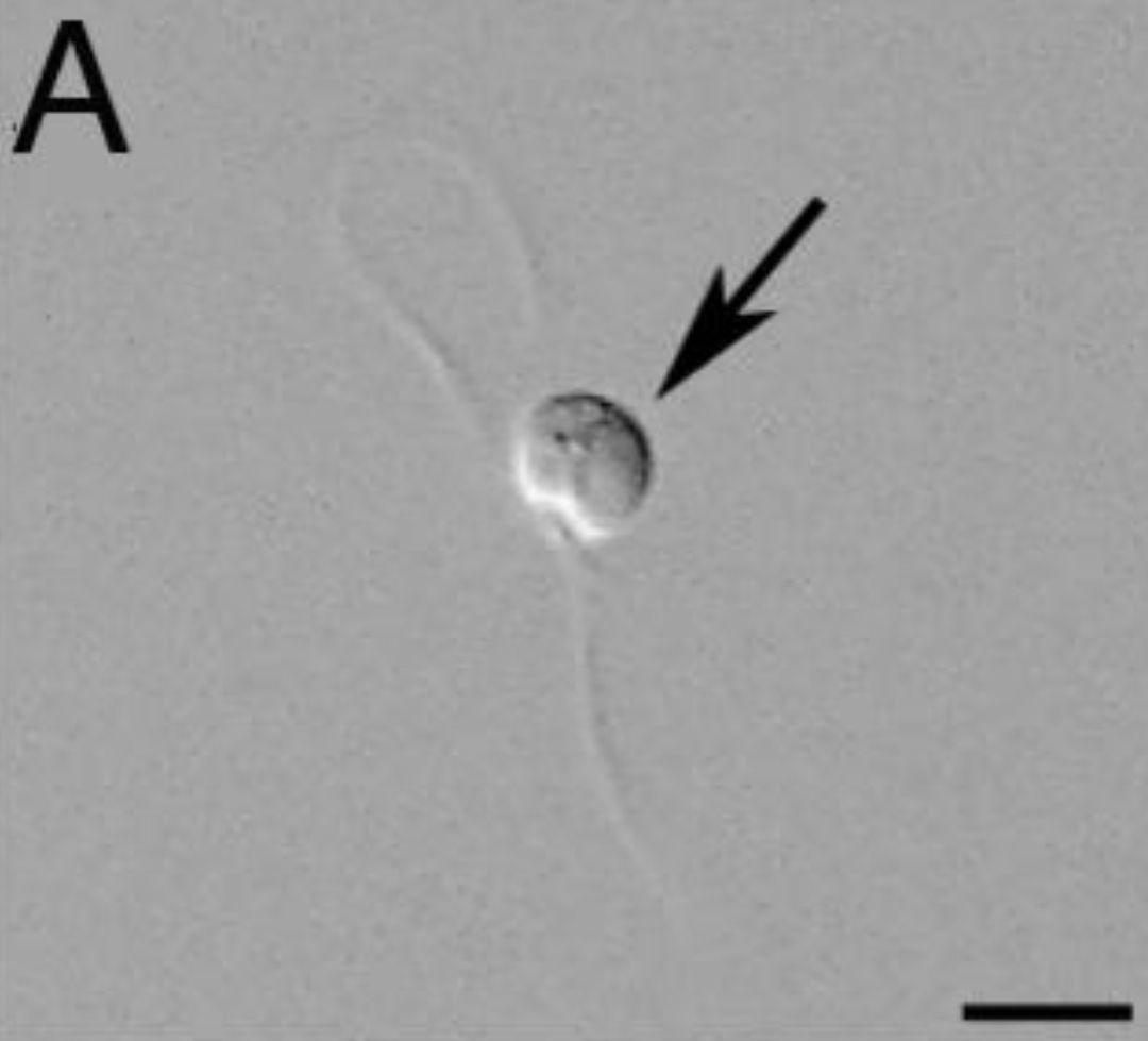 【古菌域全系列14】隐藻界Cryptista：隐于世间而影响世界 - 知乎