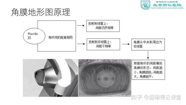角膜地形图解读及露晰得塑形镜验配要点（文字版） - 知乎
