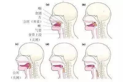 介护食品 ‖ 了解一下 - 知乎