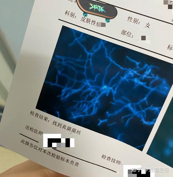 黑头反复长又非常多该怎么办？ 知乎