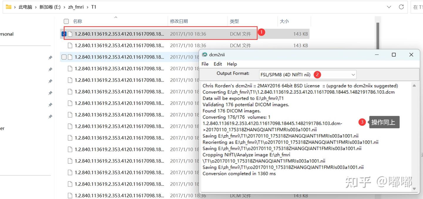 1-spm-fMRI任务态数据处理——格式转换 - 知乎