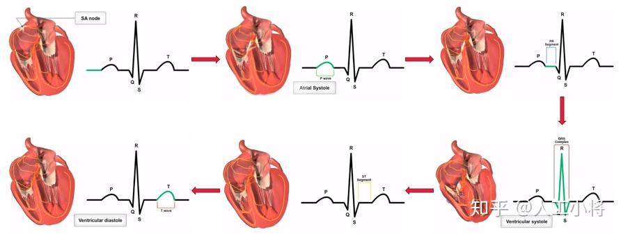 深度医疗(1) - 基于深度学习心电图(ECG)特征识别 - 知乎