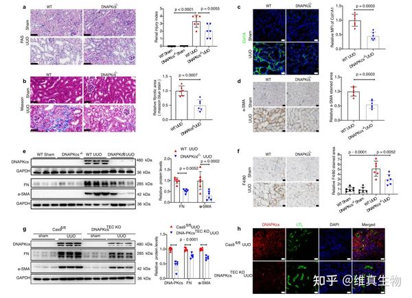 NAT COMMUN（IF17.694）｜南京医科大学附属儿童医院团队发现DNA-PKcs有望成为慢性肾脏病治疗新靶点！ - 知乎