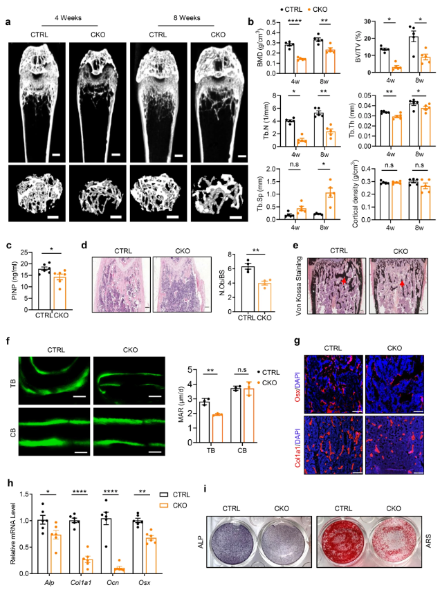 骨质疏松治疗新靶点！去泛素化酶OTUB1通过维持FGFR2稳定性调控骨形成 - 知乎
