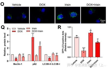 自噬研究工具 | LC3自噬慢病毒实验原理及应用 - 知乎