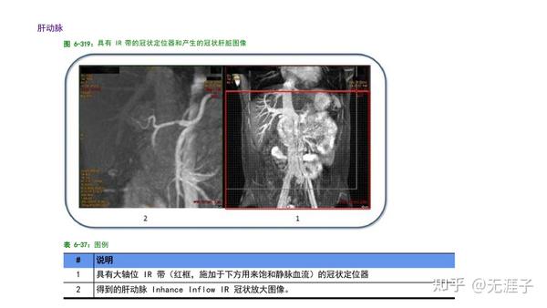 IFIR成像技术 - 知乎