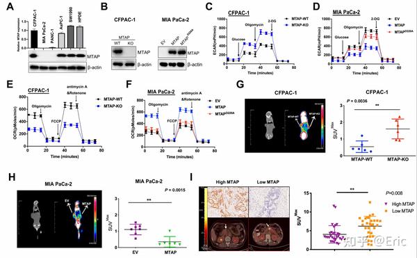 Cancer research | MTAP缺失诱导的代谢重塑增加胰腺癌嘌呤从头合成和糖酵解共靶向敏感性 - 知乎