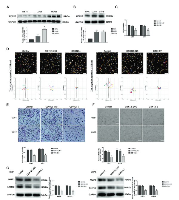 国自然热点：血管拟态你知道怎么研究吗？ - 知乎