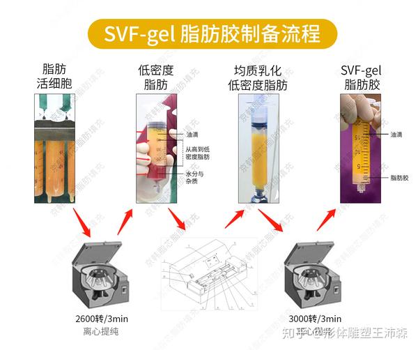 解析：脂芯SVF-gel脂肪胶是什么？它长什么样子？ - 知乎