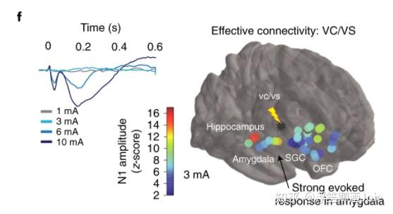 【THERAPY】Closed-loop neuromodulation in an individual with treatment ...