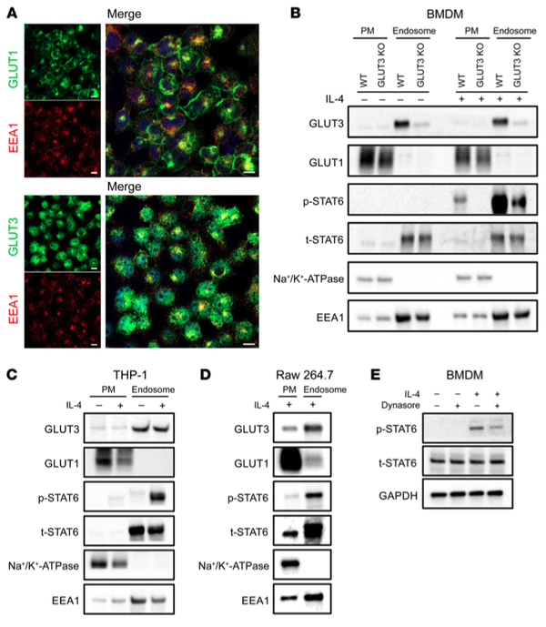 JCI丨在特应性皮炎和伤口愈合过程中，GLUT3 通过 RAS 介导的内吞作用促进巨噬细胞的信号传递和功能 - 知乎