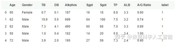 爱数课实验 | 印度肝病患者智能诊断 - 知乎