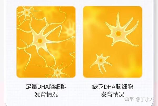 老爸测评推荐的DHA这么多人买?孕妇DHA哪个牌子好？ - 知乎
