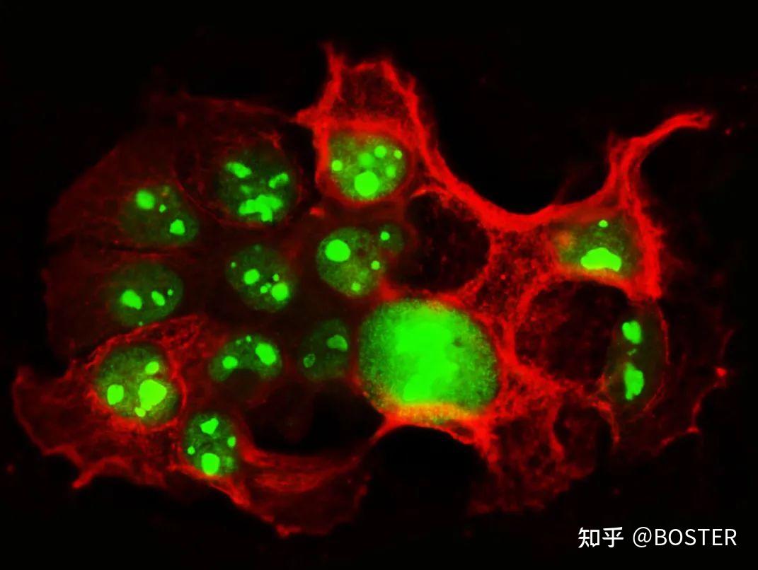 细胞器标记物蛋白的免疫组化/荧光 - 知乎