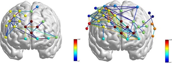 Journal of Affective Disorders: θ爆发式经颅磁刺激治疗焦虑和抑郁的FNIRS证据 - 知乎