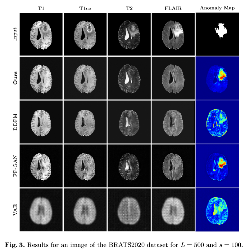 Diffusion Models for Medical Anomaly Detection - 知乎
