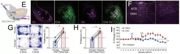【文献解读】Cell丨脑肠轴如何调控奖赏系统？ - 知乎
