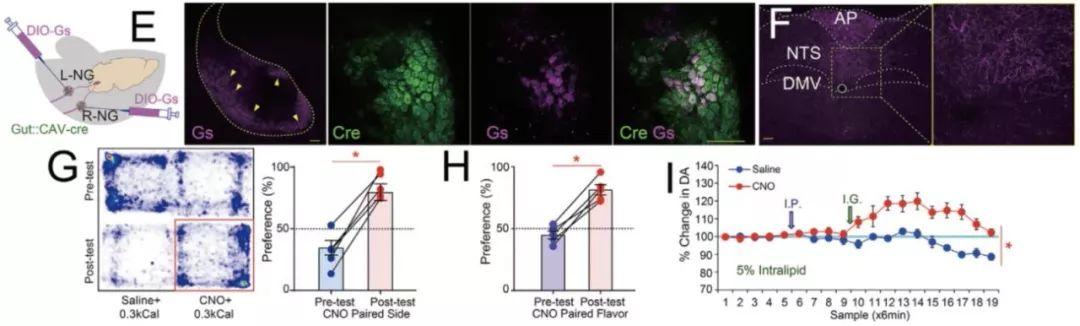【文献解读】Cell丨脑肠轴如何调控奖赏系统？ - 知乎
