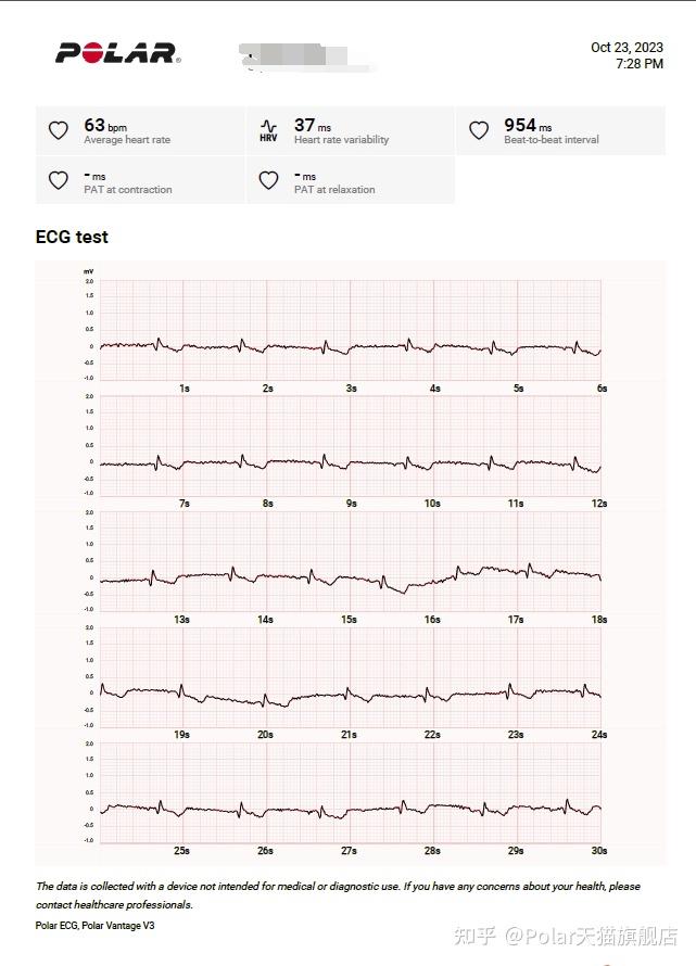 Polar Vantage V3 新功能之一：腕式ECG - 知乎