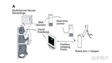 关于Neuralink的一些想法 - 知乎