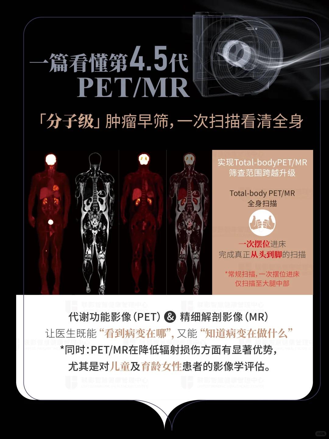 一篇讲透高端影像PET/MR，上海这台“稀缺王”已落地联影智慧健康管理中心 - 知乎
