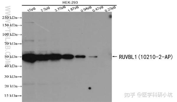 WB又出现杂带，你考虑过这个环节吗？ - 知乎